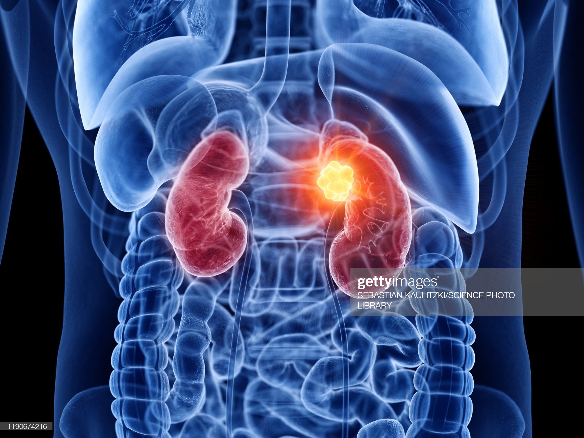 Subscriber Information - KidneyX